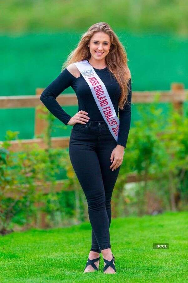 Beauty Queen left with horrific facial injuries in bar fight