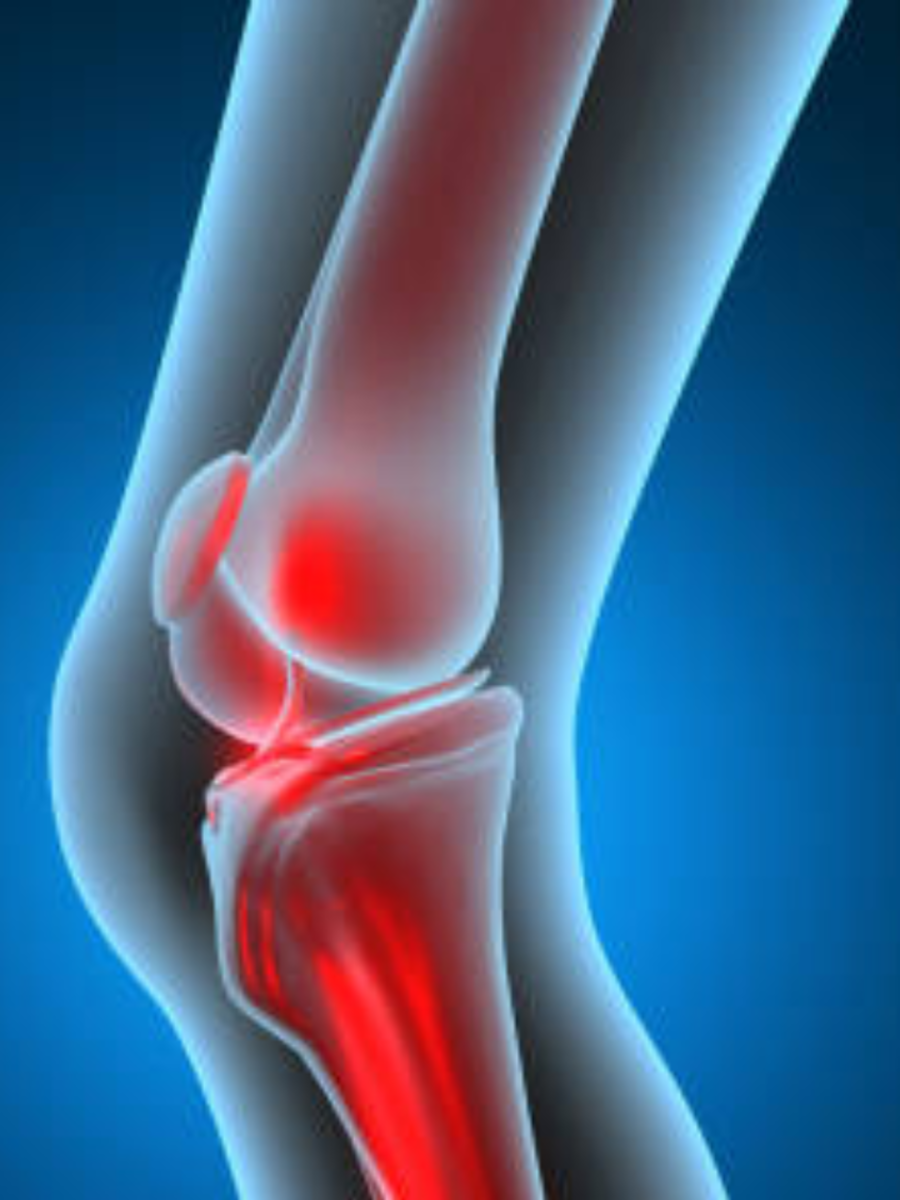 7 Ways To Build Stronger Bones and Prevent Osteoporosis | Times Now