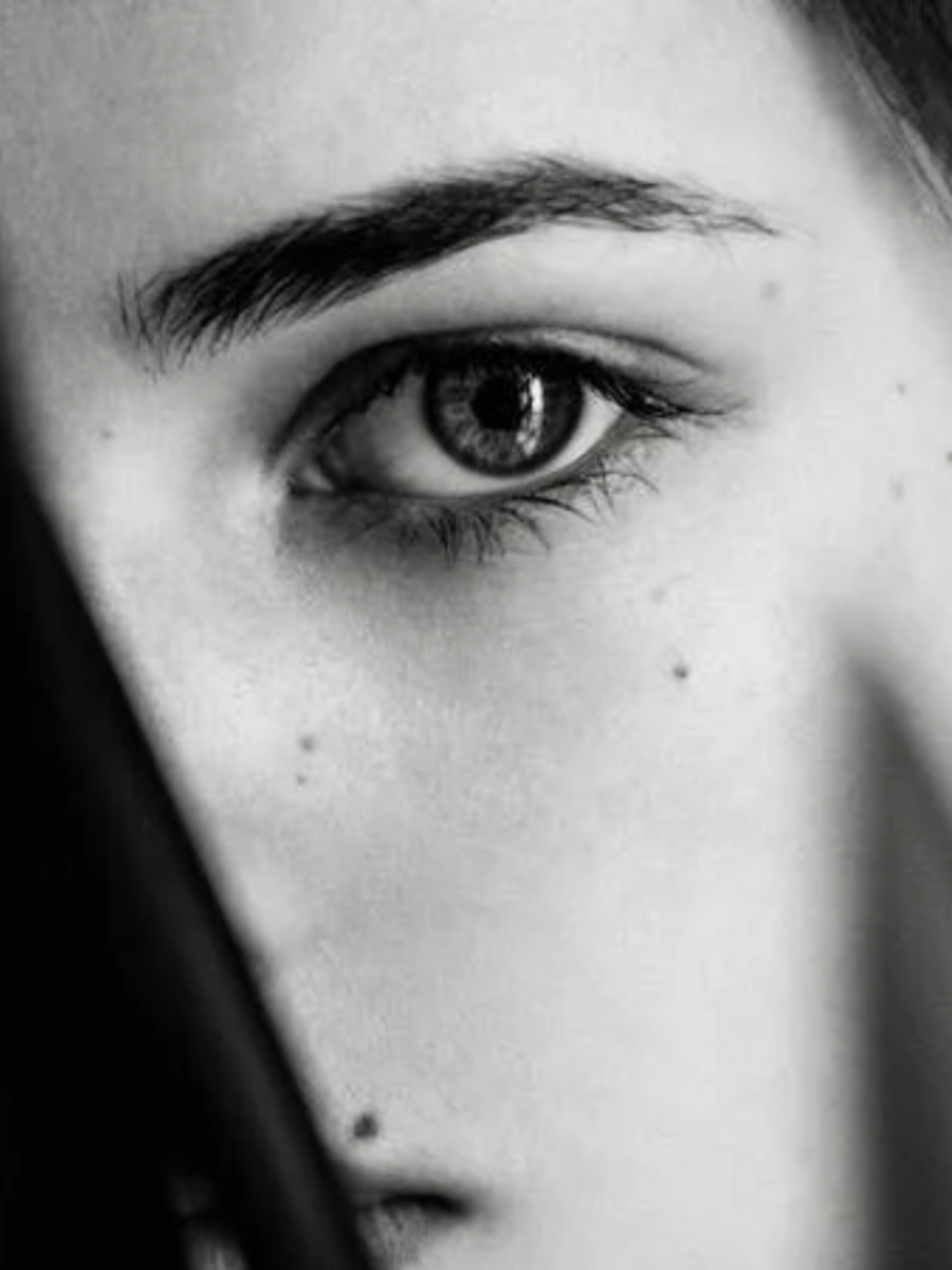 Mole On Body Meaning | Hidden Meanings Behind These Marks On Face ...