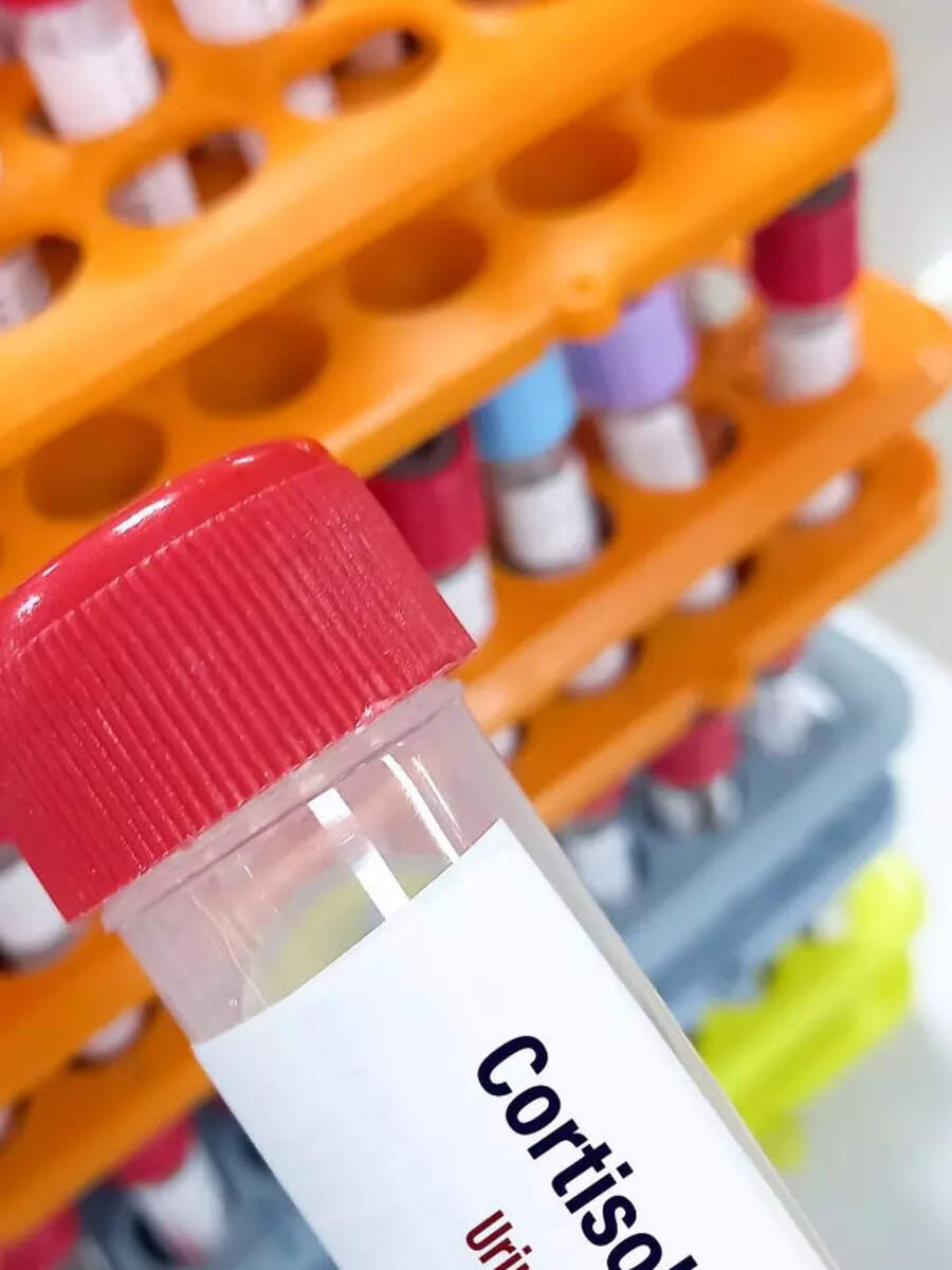 High Cortisol Symptoms : 7 Signs That Tell You Have High Cortisol ...