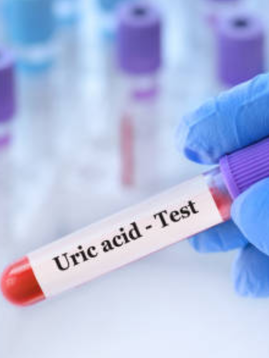 9 Early Warning Signs Of High Uric Acid You Shouldn’t Ignore | Times Now