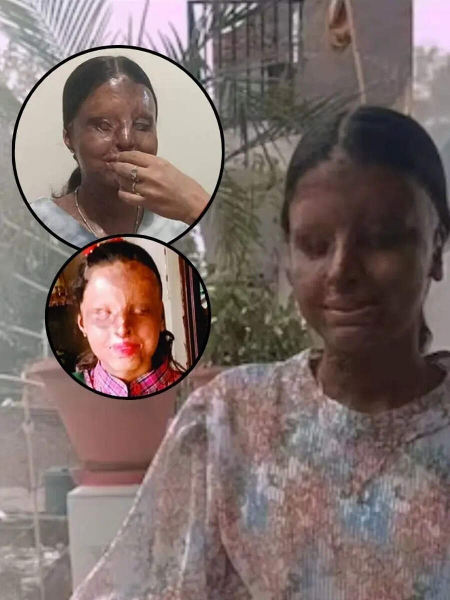 success story of acid attack survivor girl kafi who topped her blind ...
