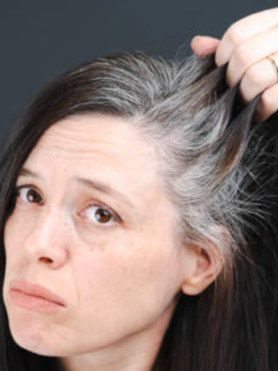 మీ జుట్టు తెల్లబడిపోతుందా? అయితే మీ డైట్‌ నుండి ఈ 8 రకాల ఫుడ్ వెంటనే ...