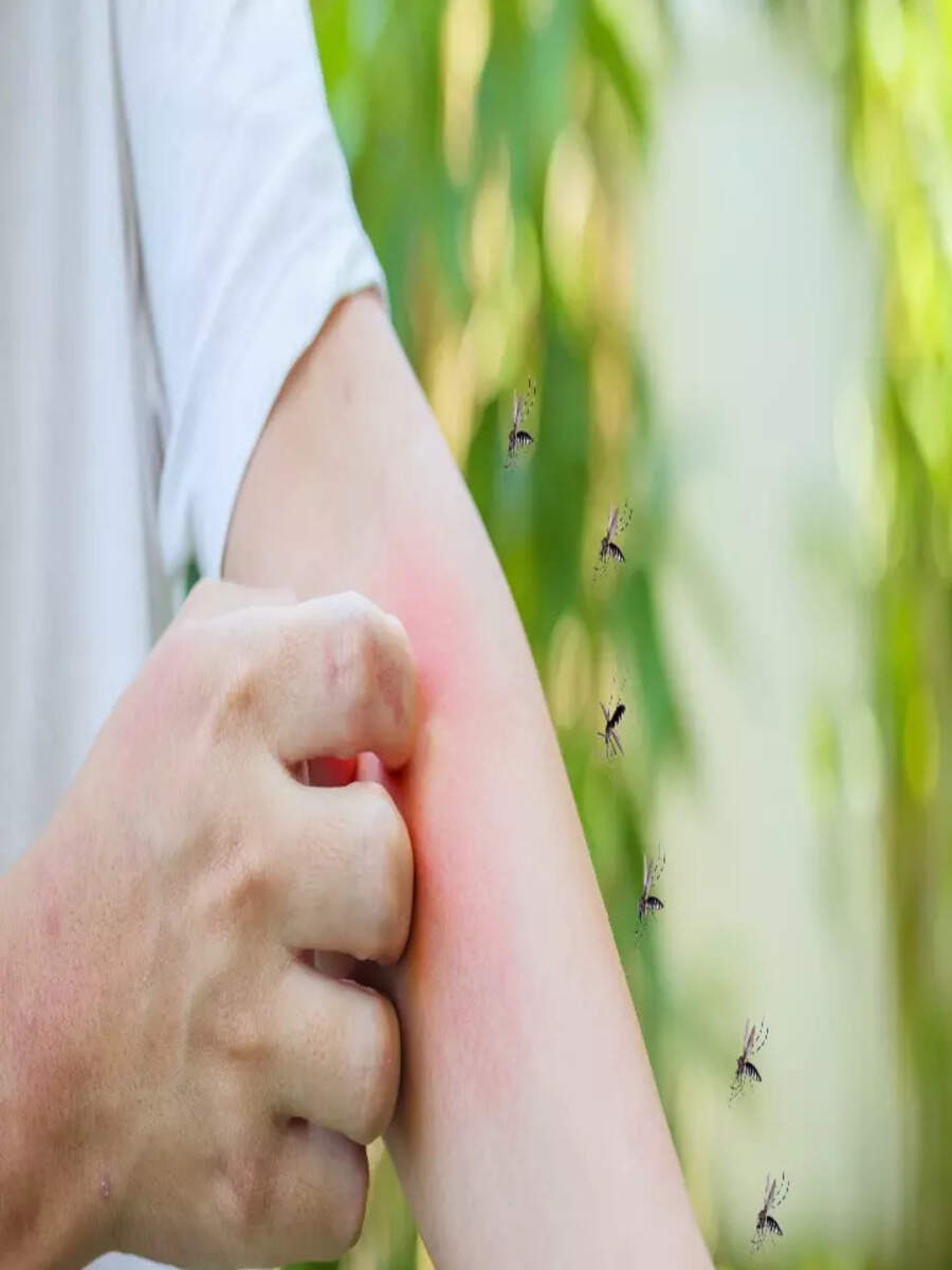 Rise in Dengue cases: Here’s all you need to know about the mosquito-borne disease | Times Now