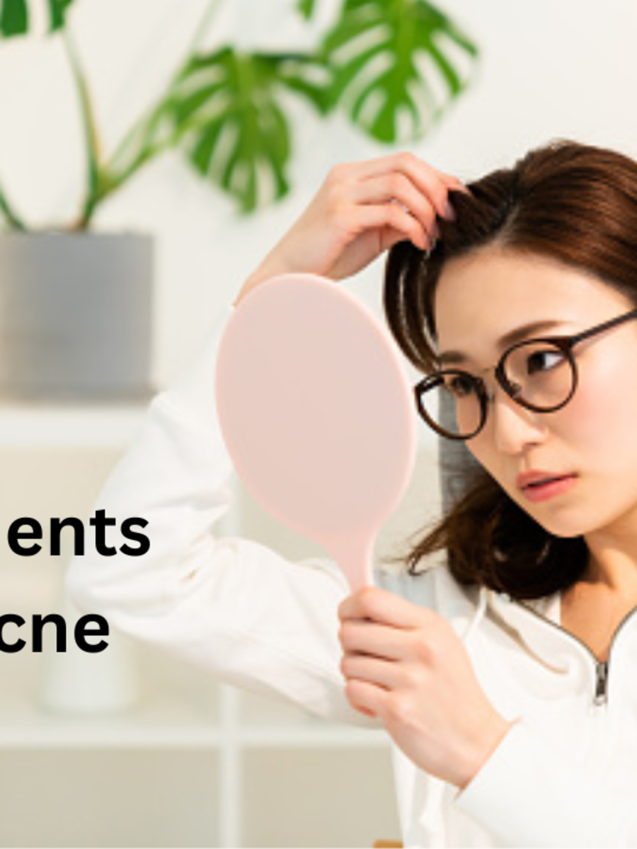 Acne on Scalp | Get rid of pesky hair acne with these simple and ...