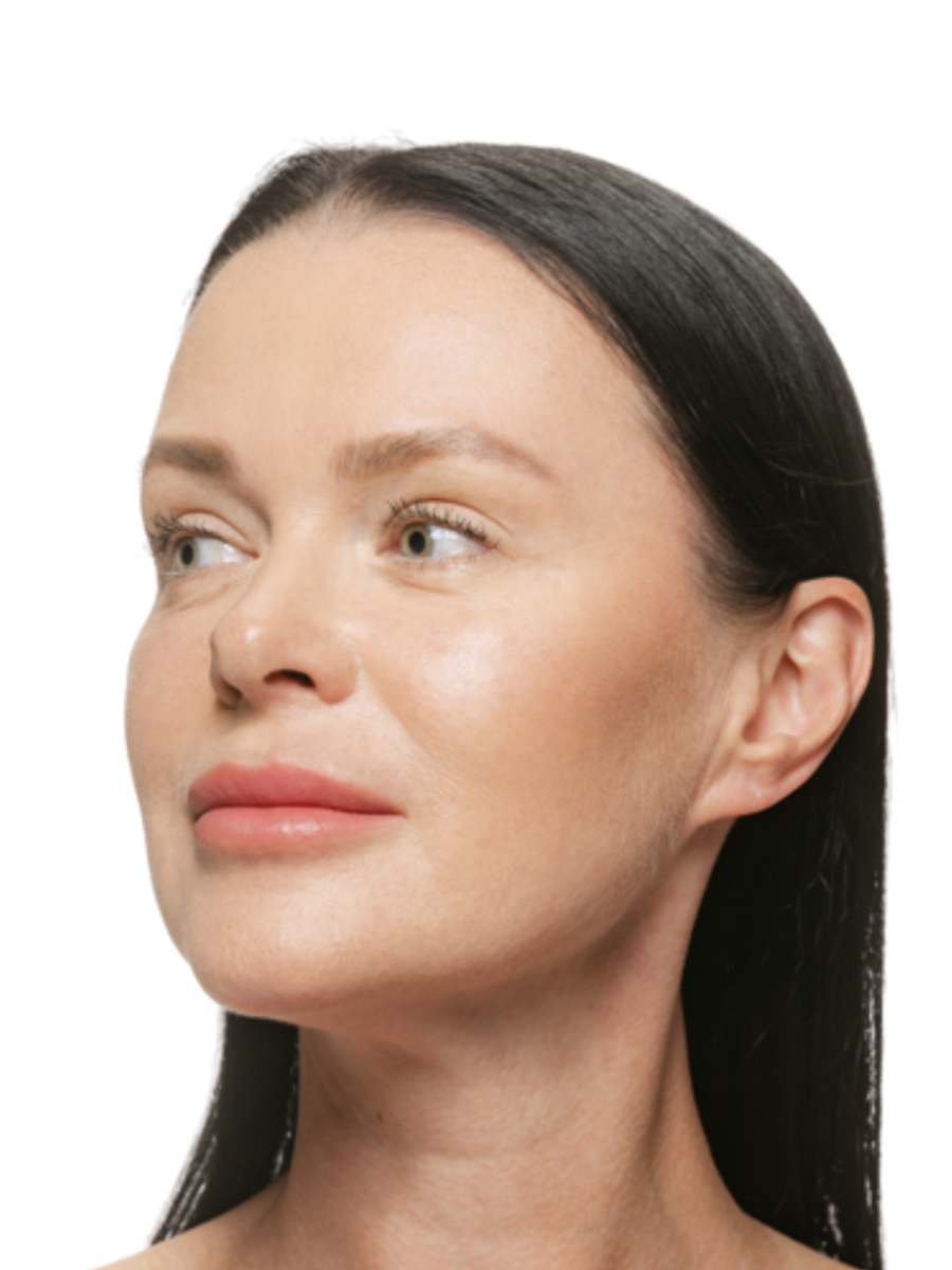 Neck Wrinkles Remedy: 9 Remedies And Tips For A Flawless Neck | Zoom TV